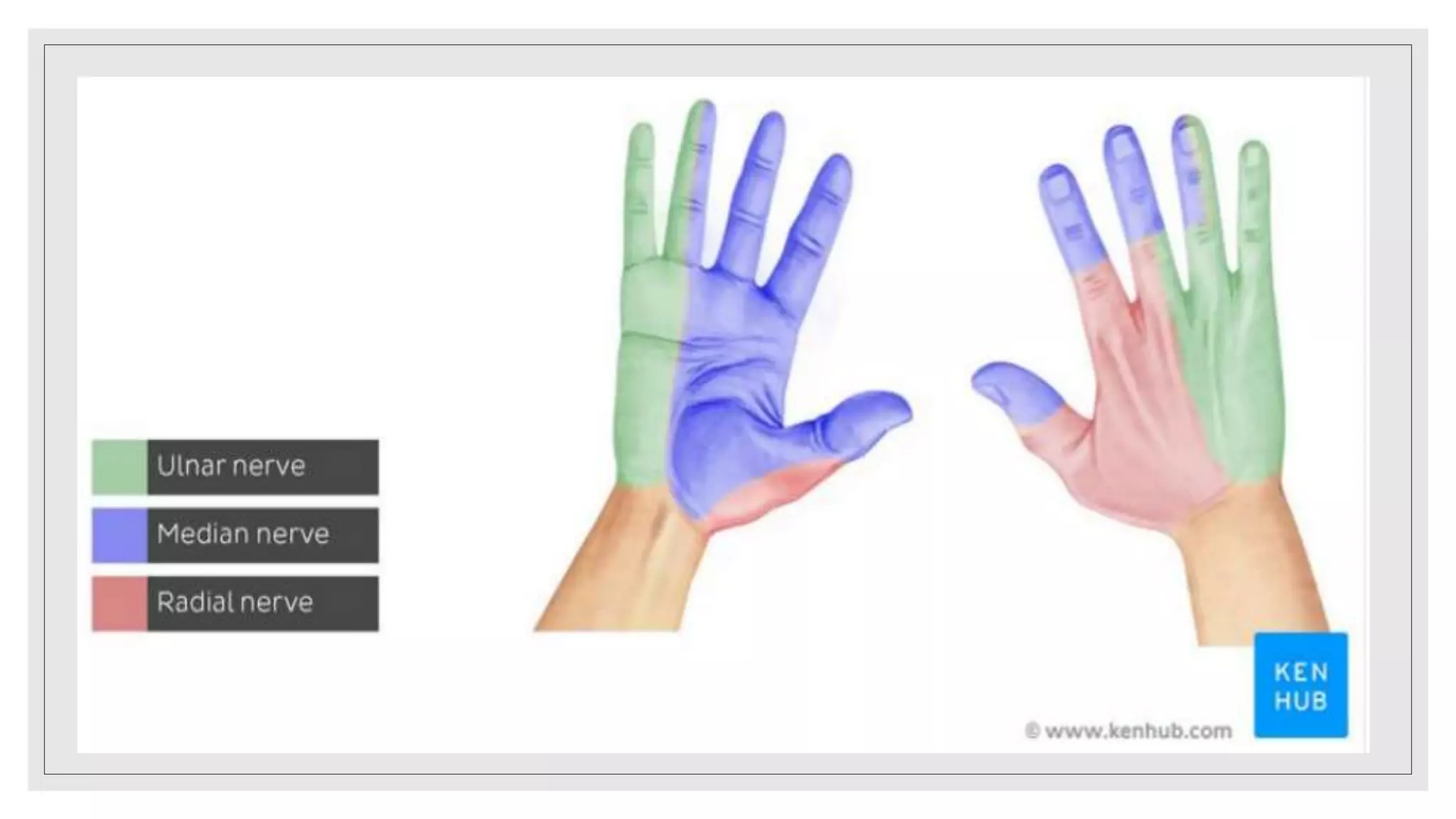 Upper limb peripheral neuropathy.pptx