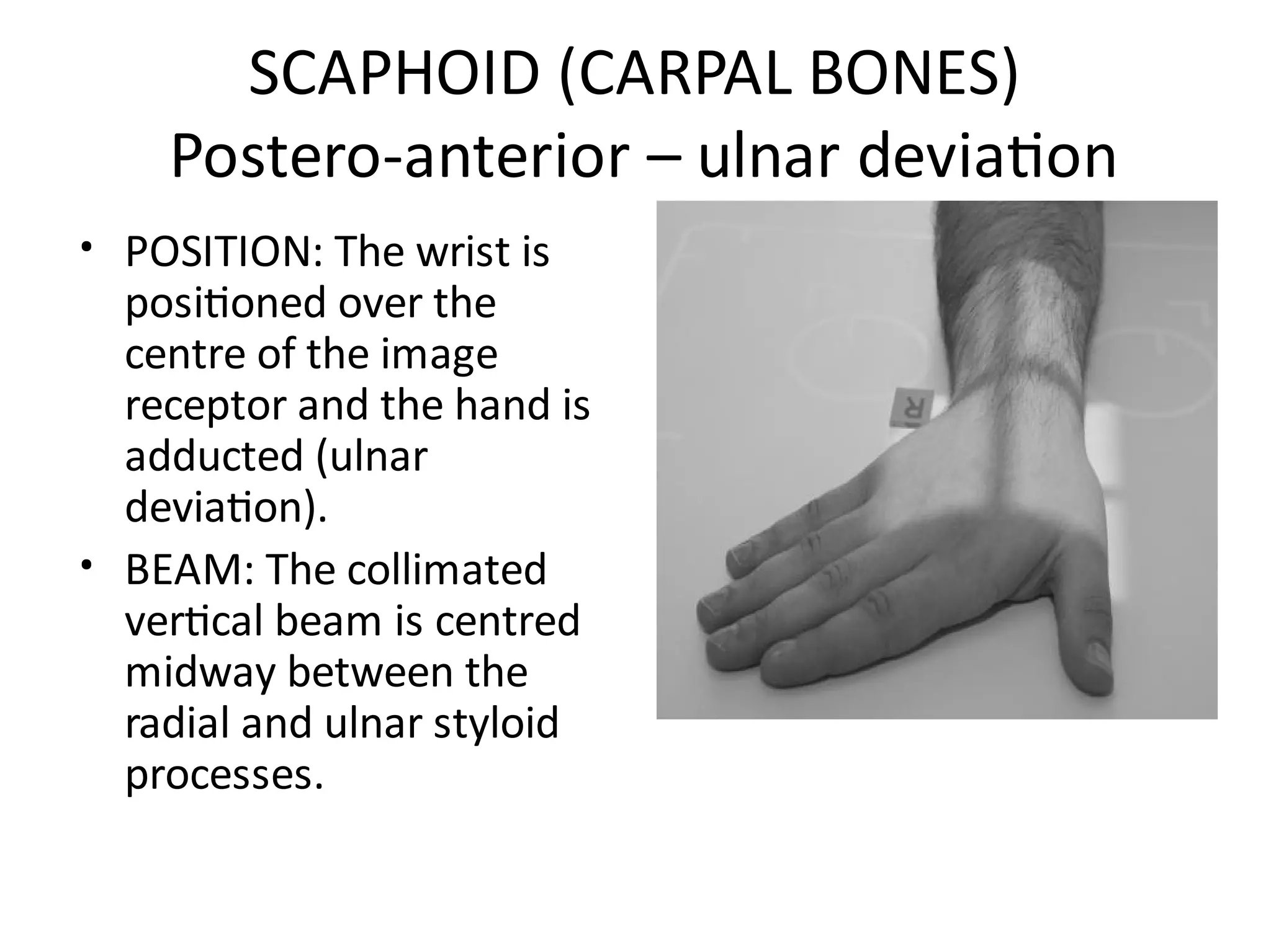 Upper Limb Plain Radiology: DR. MITESH J. PATEL(M.S ORTHO) | PDF