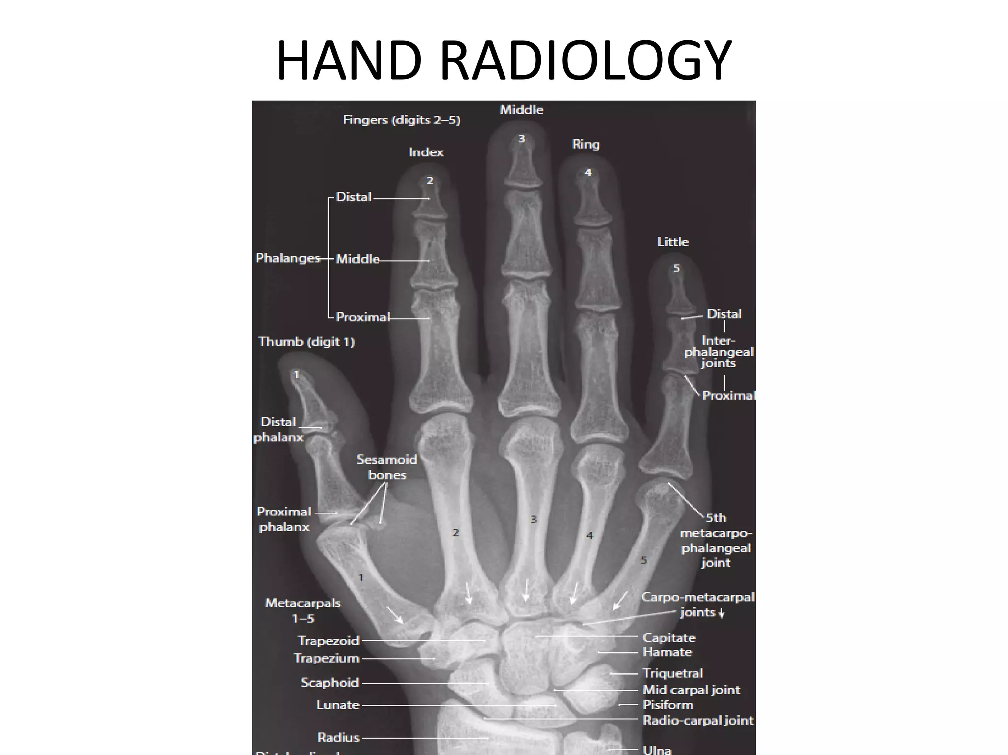 Upper Limb Plain Radiology: DR. MITESH J. PATEL(M.S ORTHO) | PDF