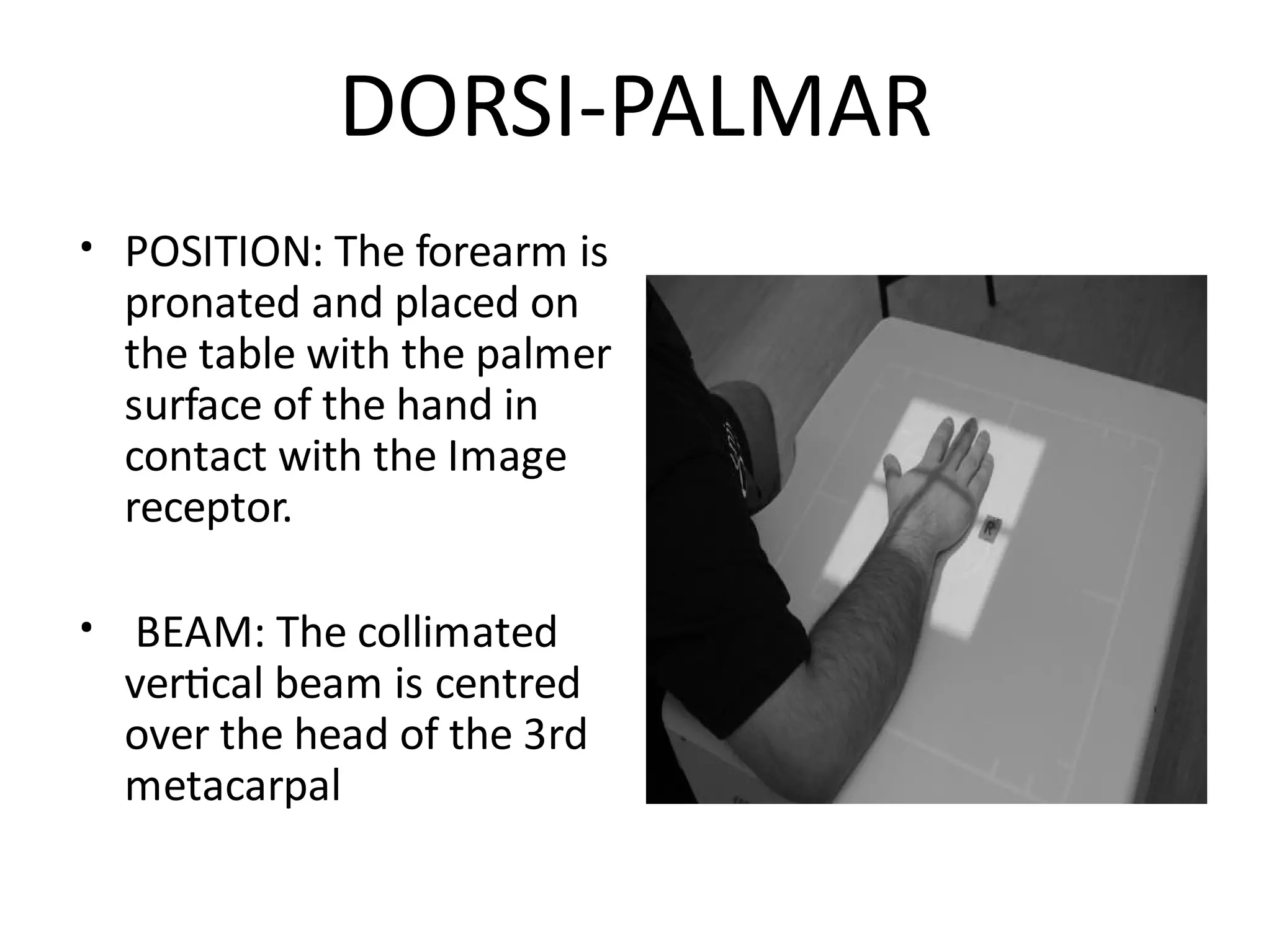 Upper Limb Plain Radiology: DR. MITESH J. PATEL(M.S ORTHO) | PDF