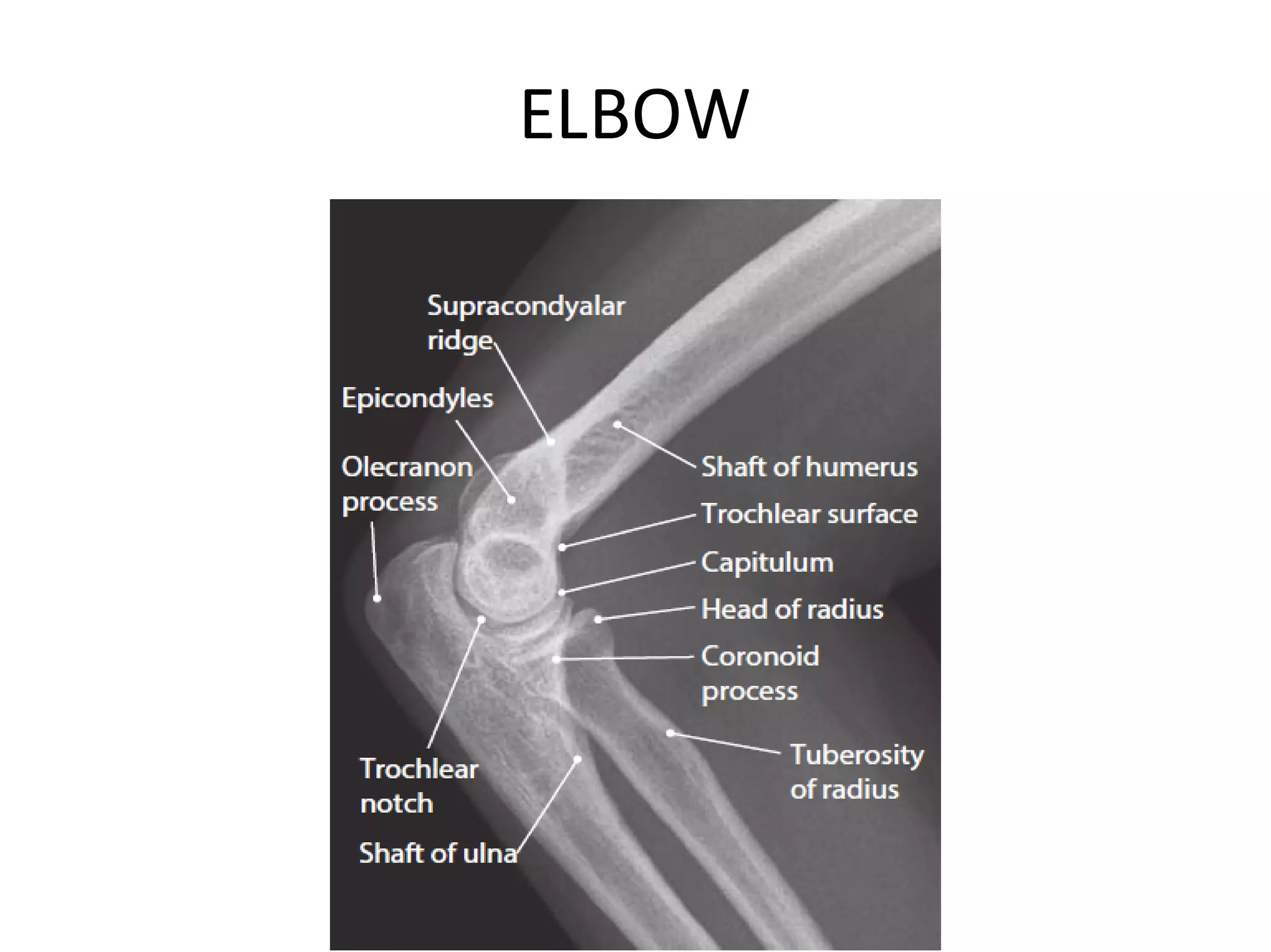 Upper Limb Plain Radiology: DR. MITESH J. PATEL(M.S ORTHO) | PPT | Free ...