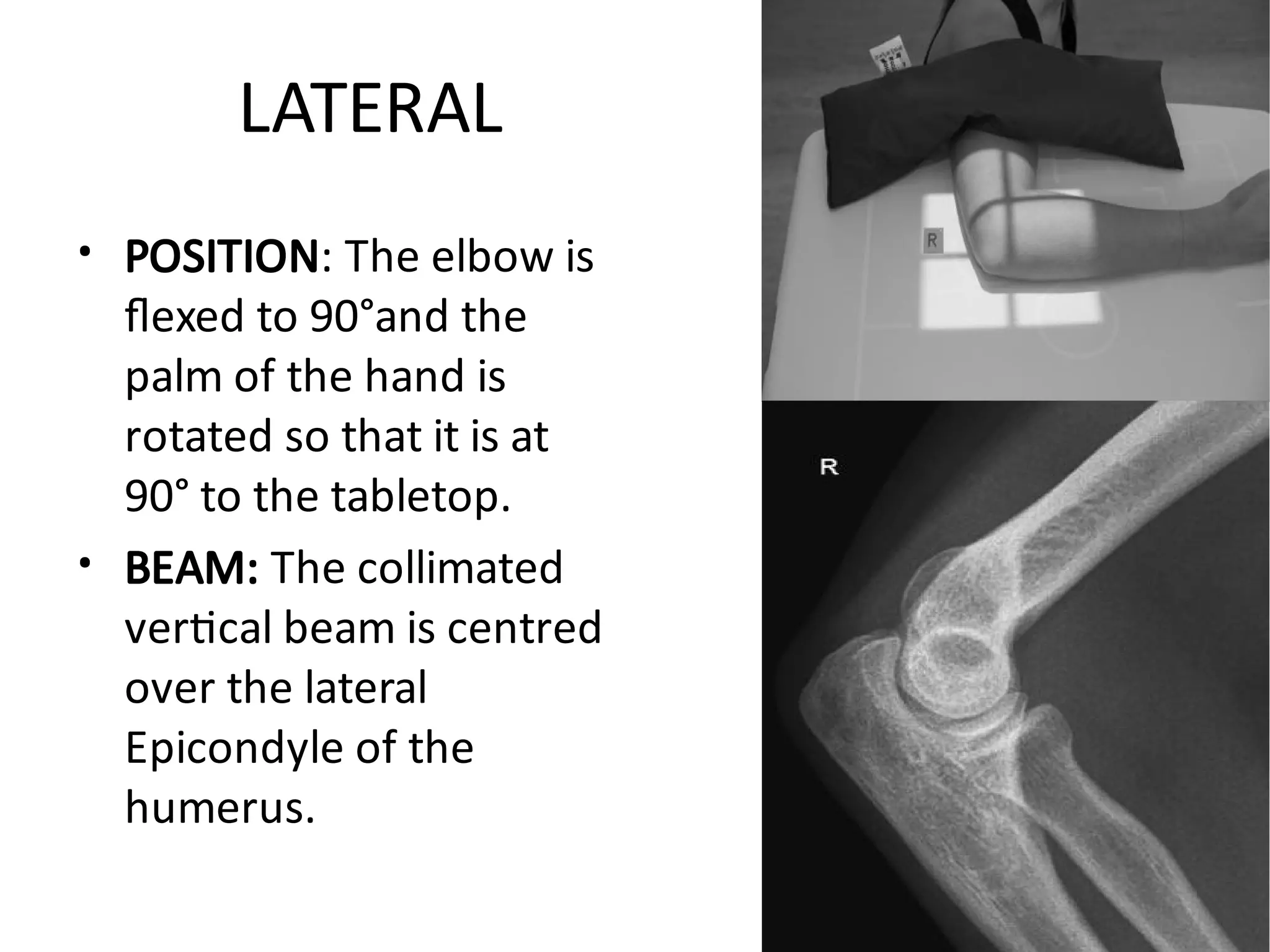 Upper Limb Plain Radiology: DR. MITESH J. PATEL(M.S ORTHO) | PPT | Free ...