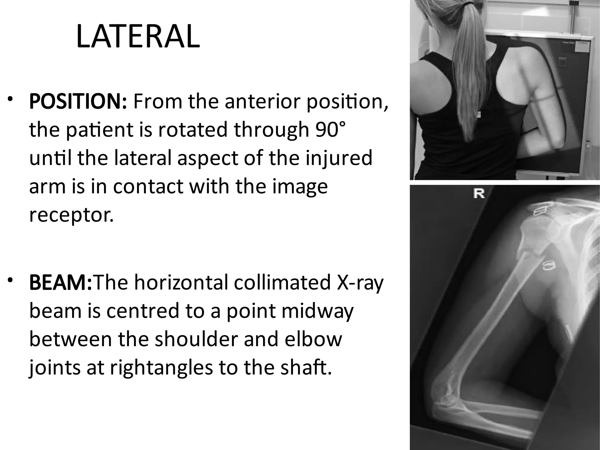 Upper Limb Plain Radiology: DR. MITESH J. PATEL(M.S ORTHO) | PPT | Free ...