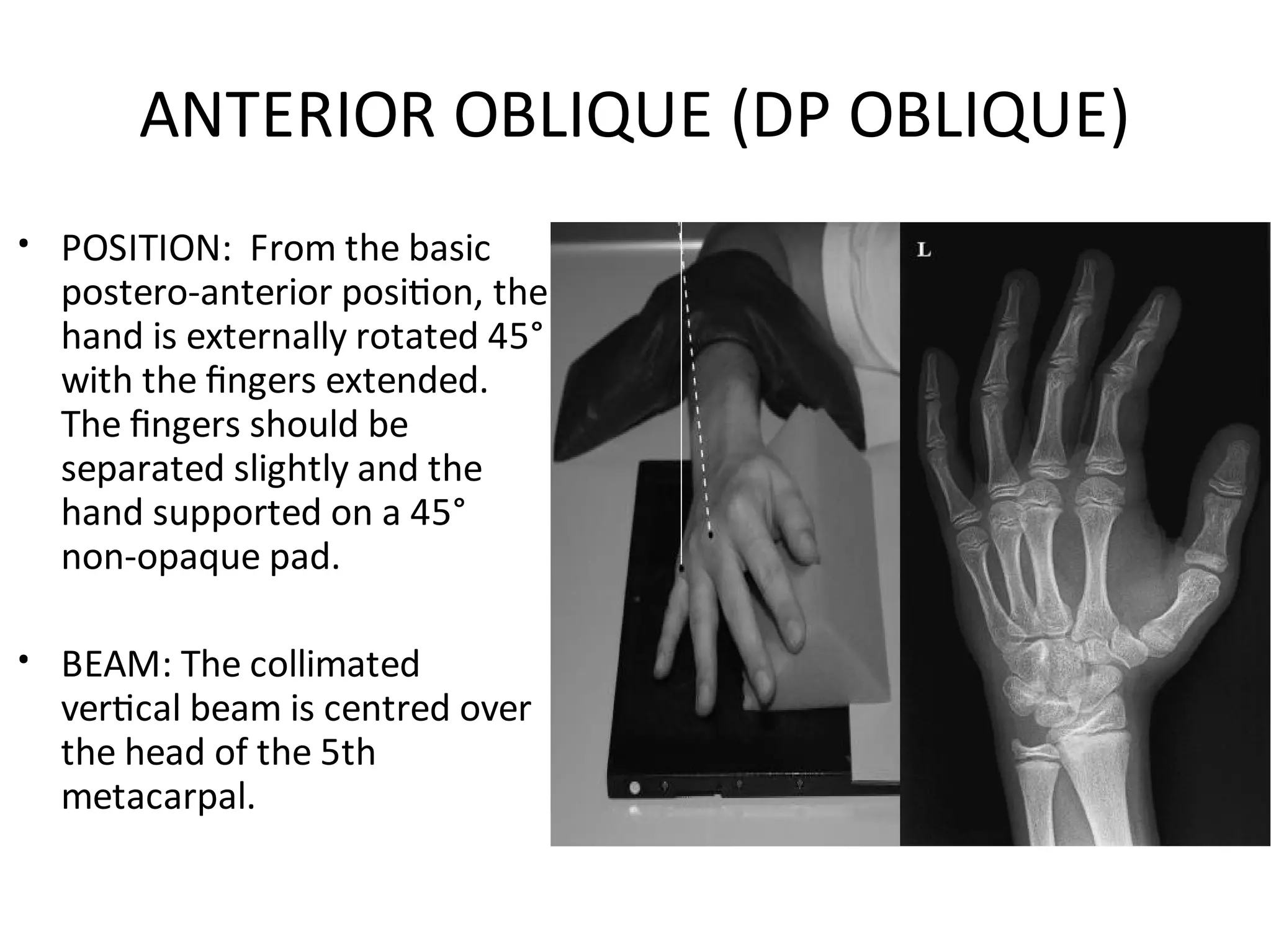 Upper Limb Plain Radiology: DR. MITESH J. PATEL(M.S ORTHO) | PDF