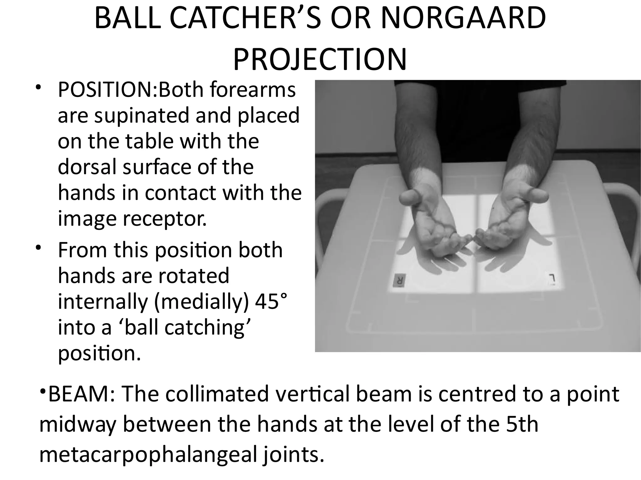 Upper Limb Plain Radiology: DR. MITESH J. PATEL(M.S ORTHO) | PDF