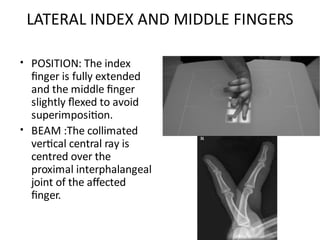 Upper Limb Plain Radiology: DR. MITESH J. PATEL(M.S ORTHO) | PDF