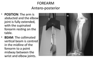 Upper Limb Plain Radiology: DR. MITESH J. PATEL(M.S ORTHO) | PDF