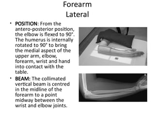 Upper Limb Plain Radiology: DR. MITESH J. PATEL(M.S ORTHO) | PDF