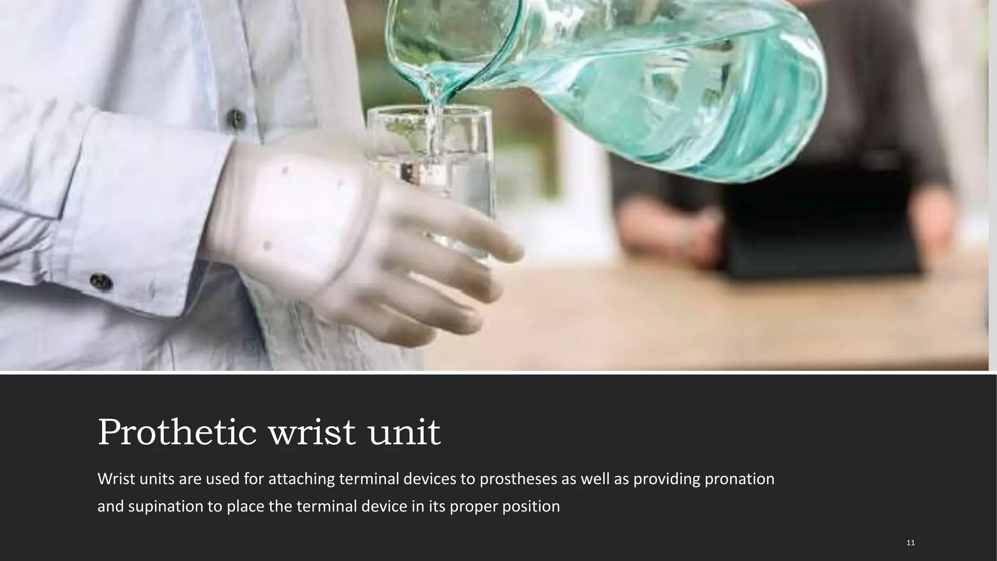 Upper limb prostheses | PPTX