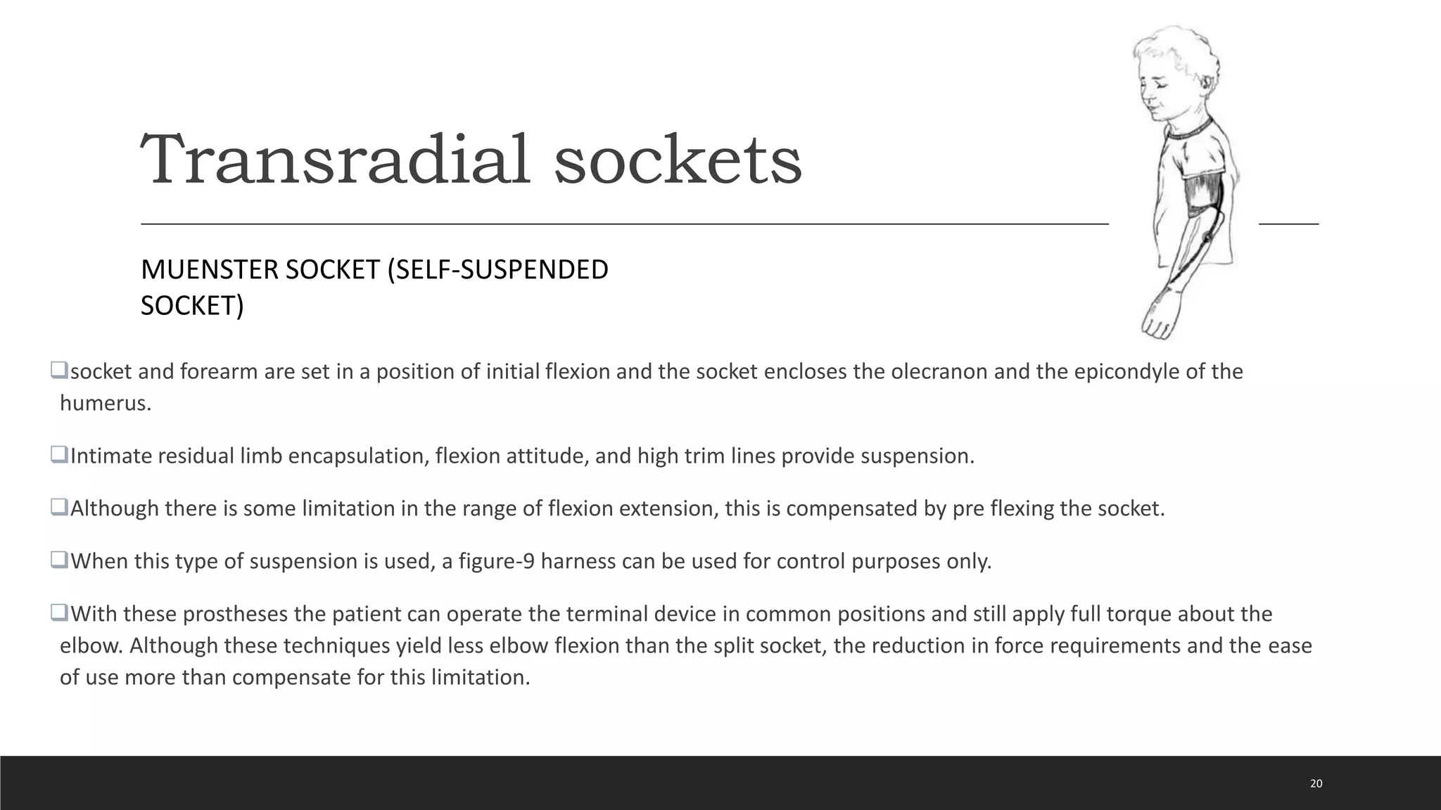 Upper limb prostheses | PPTX