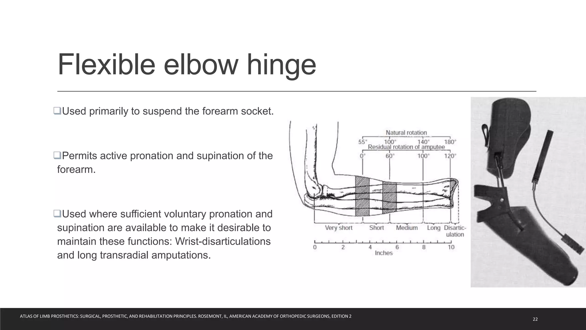 Upper limb prostheses | PPTX