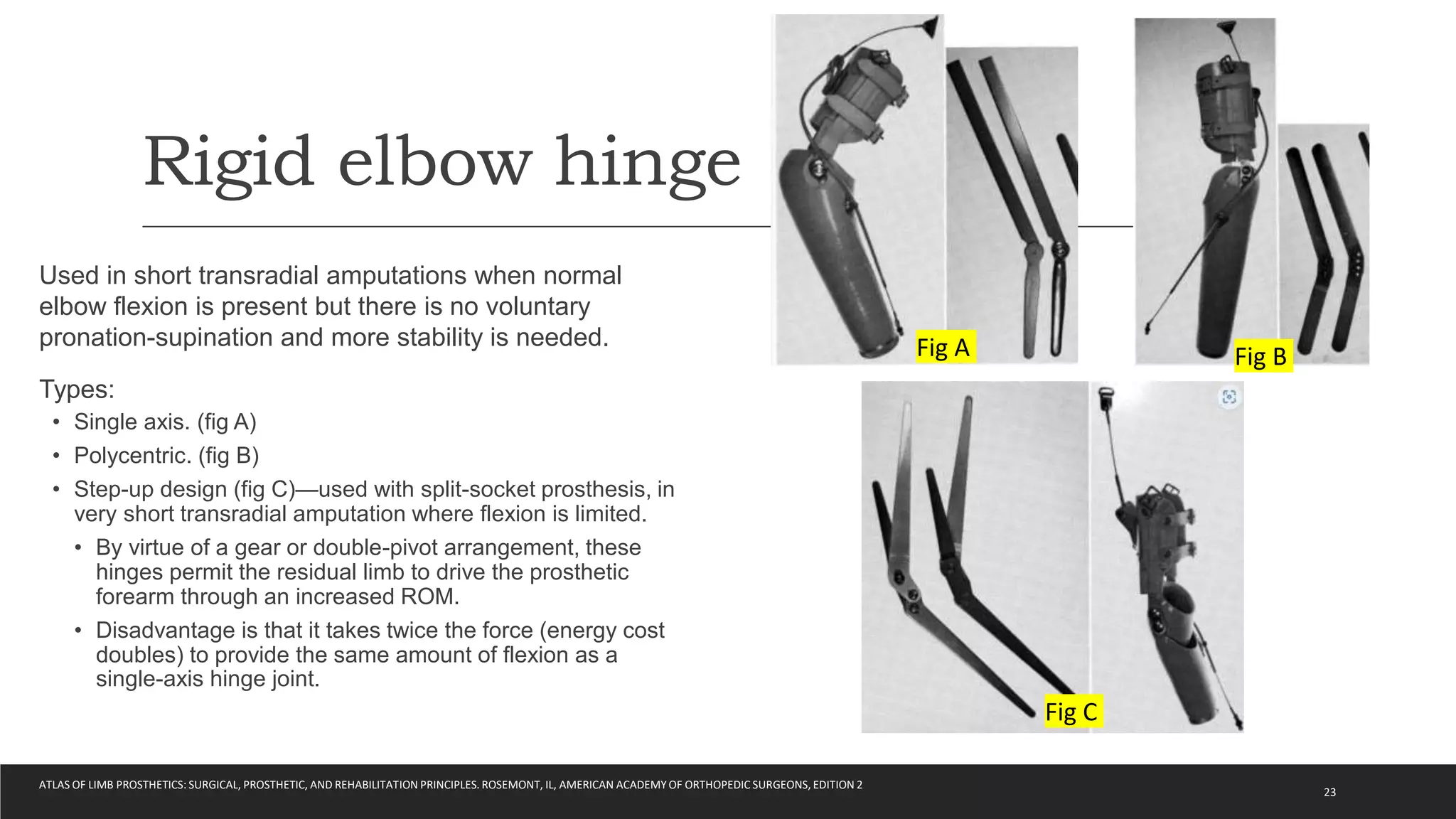 Upper limb prostheses | PPTX