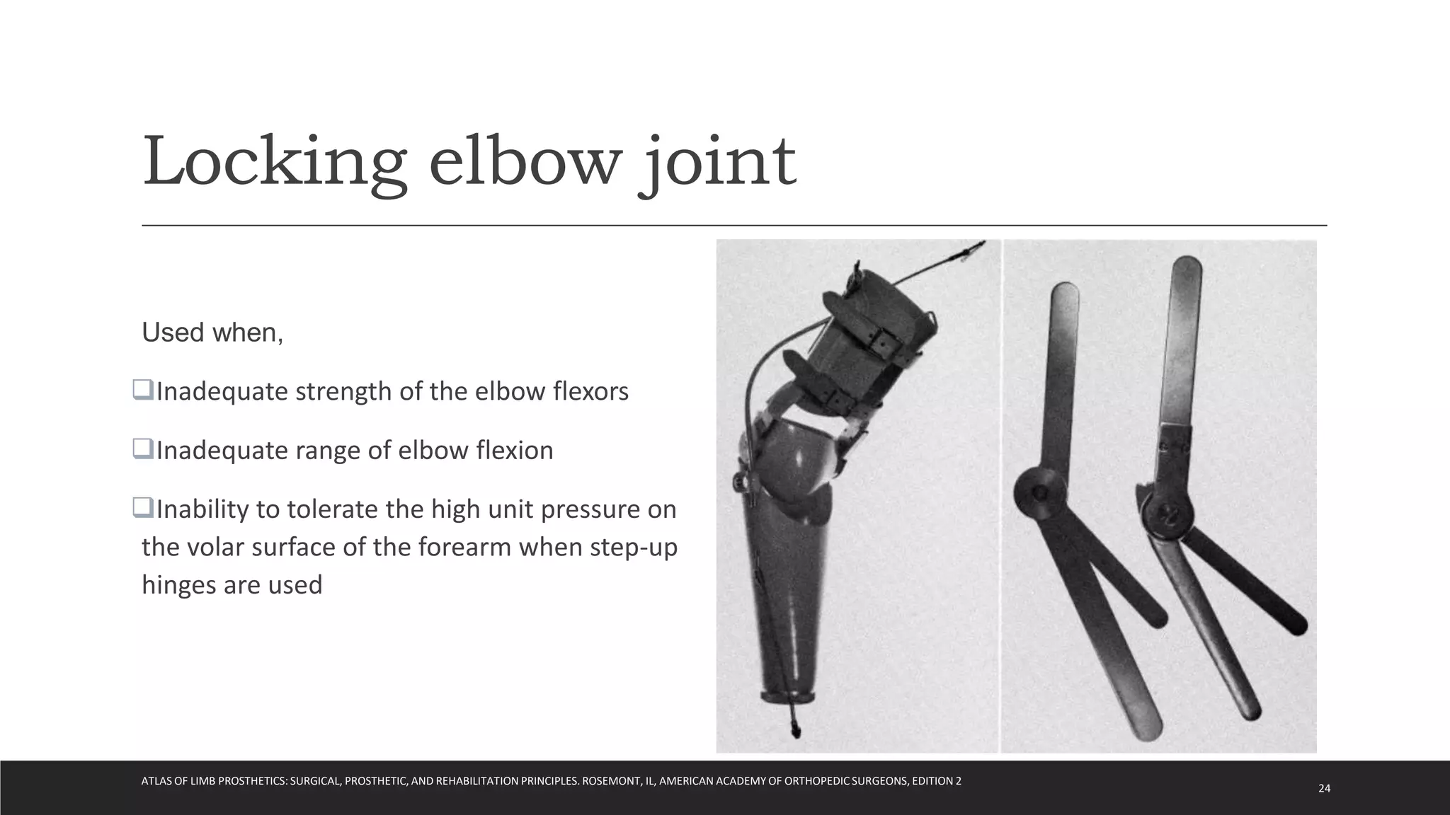 Upper limb prostheses | PPTX