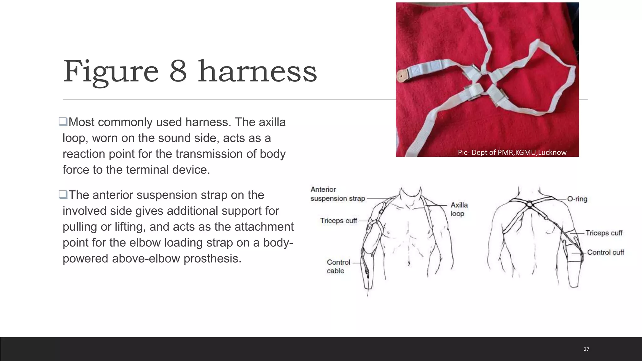 Upper limb prostheses | PPTX