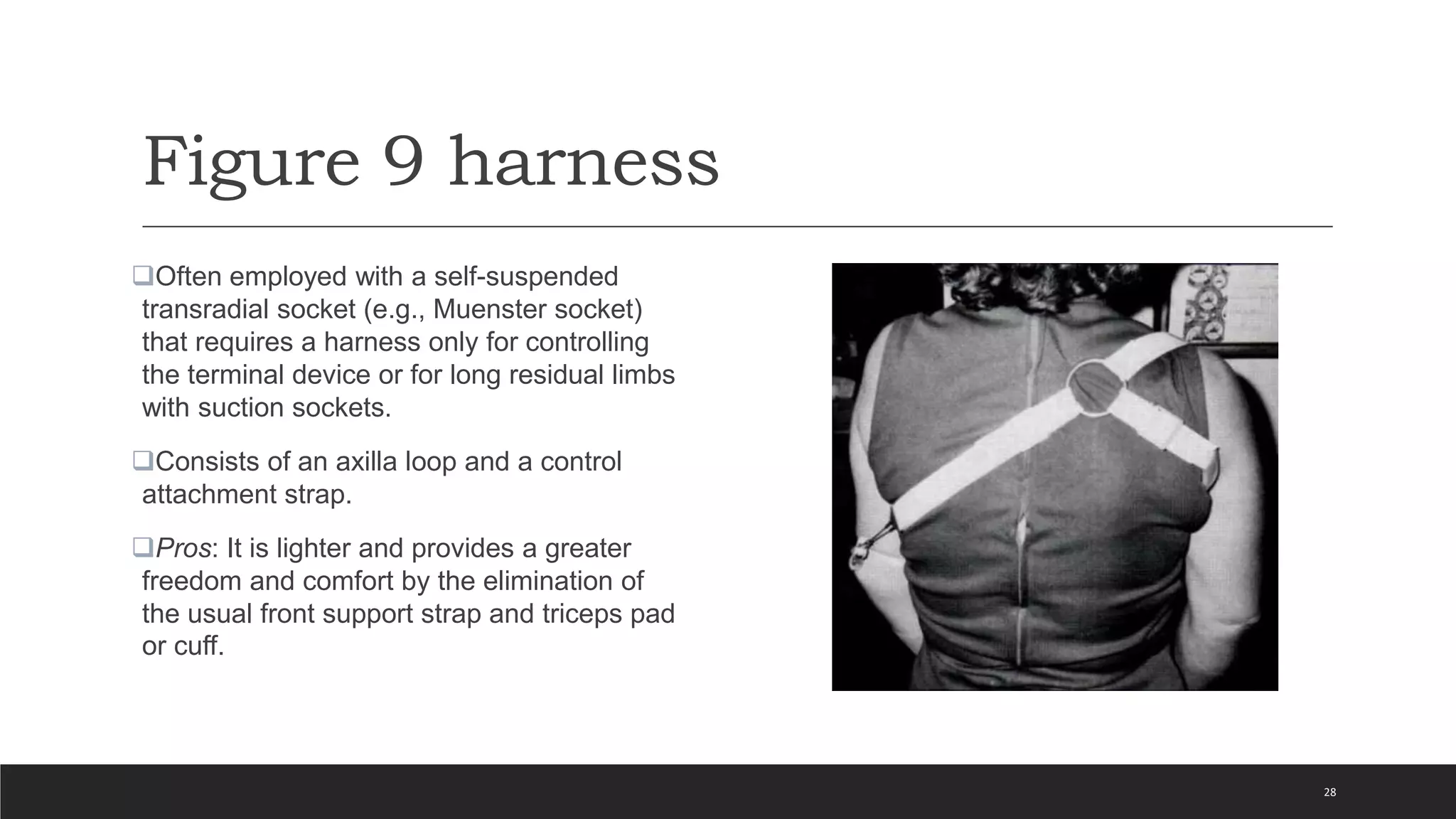 Upper limb prostheses | PPTX