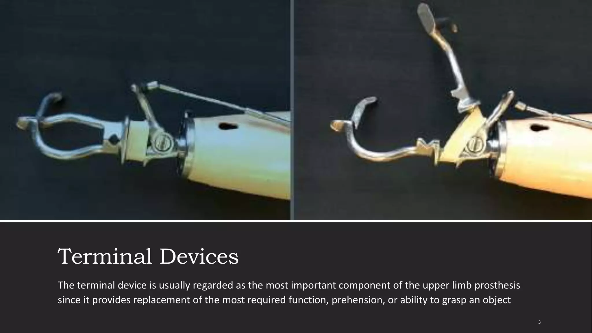 Upper limb prostheses | PPTX