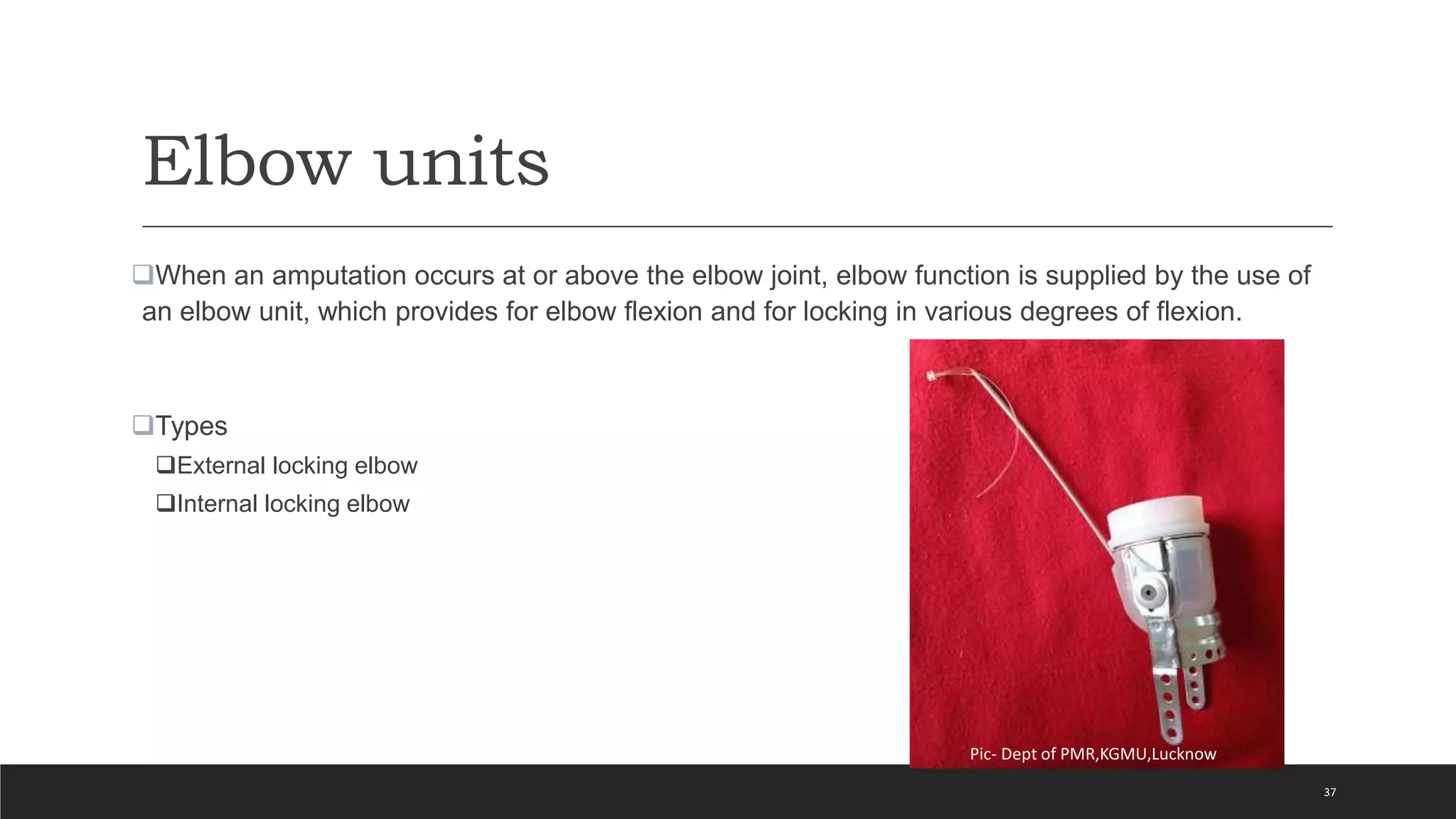 Upper limb prostheses | PPTX