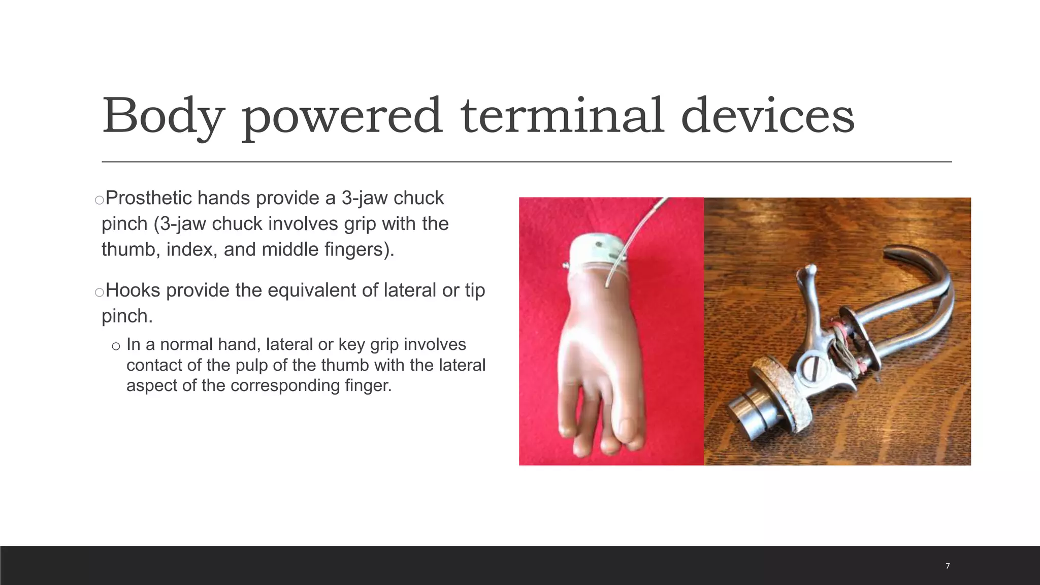 Upper limb prostheses | PPTX