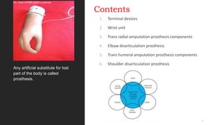 Upper limb prostheses | PPTX