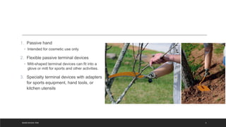 Upper limb prostheses | PPTX