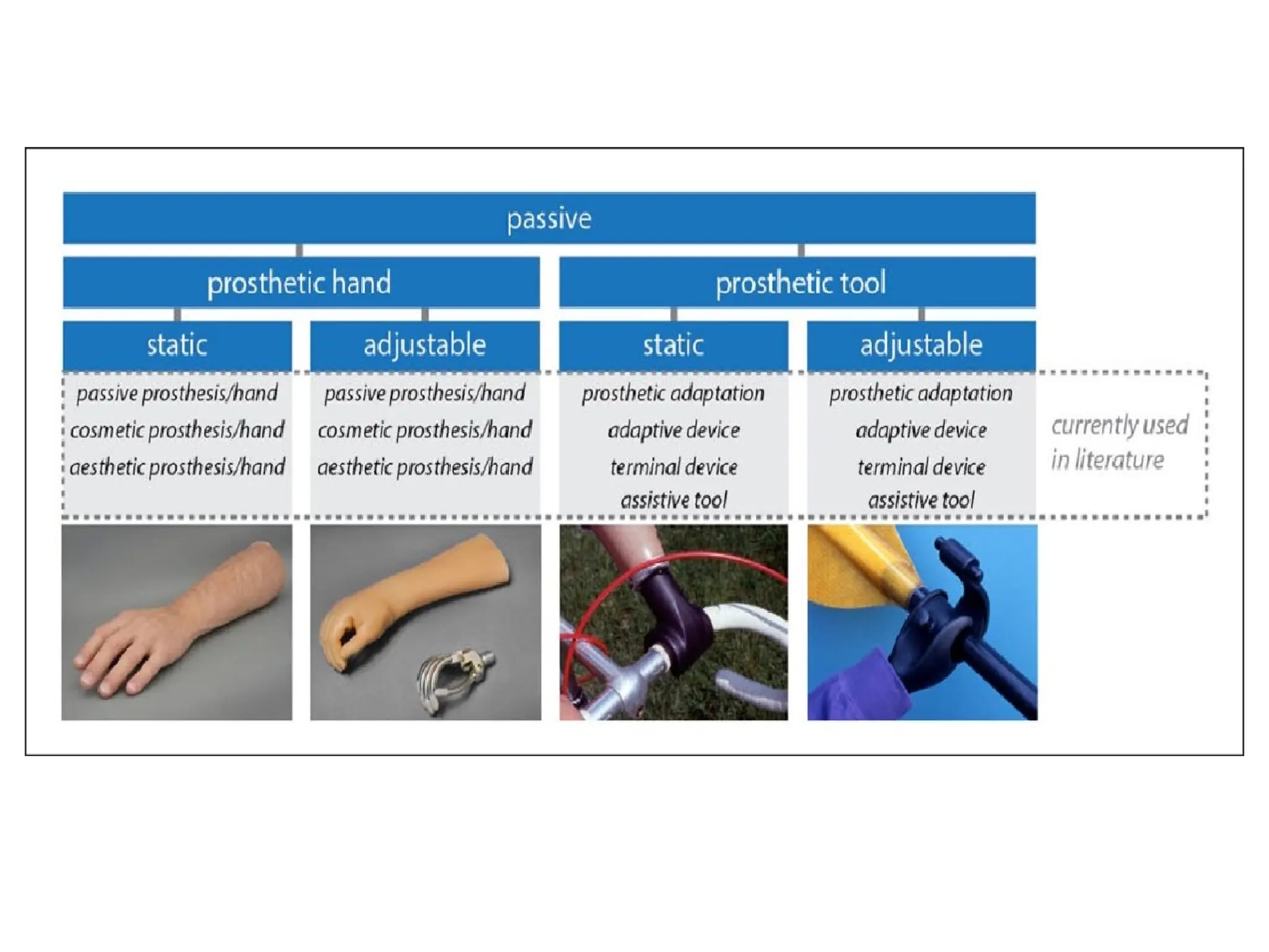 UPPER LIMB PROSTHESIS.pptx....................... | PPTX