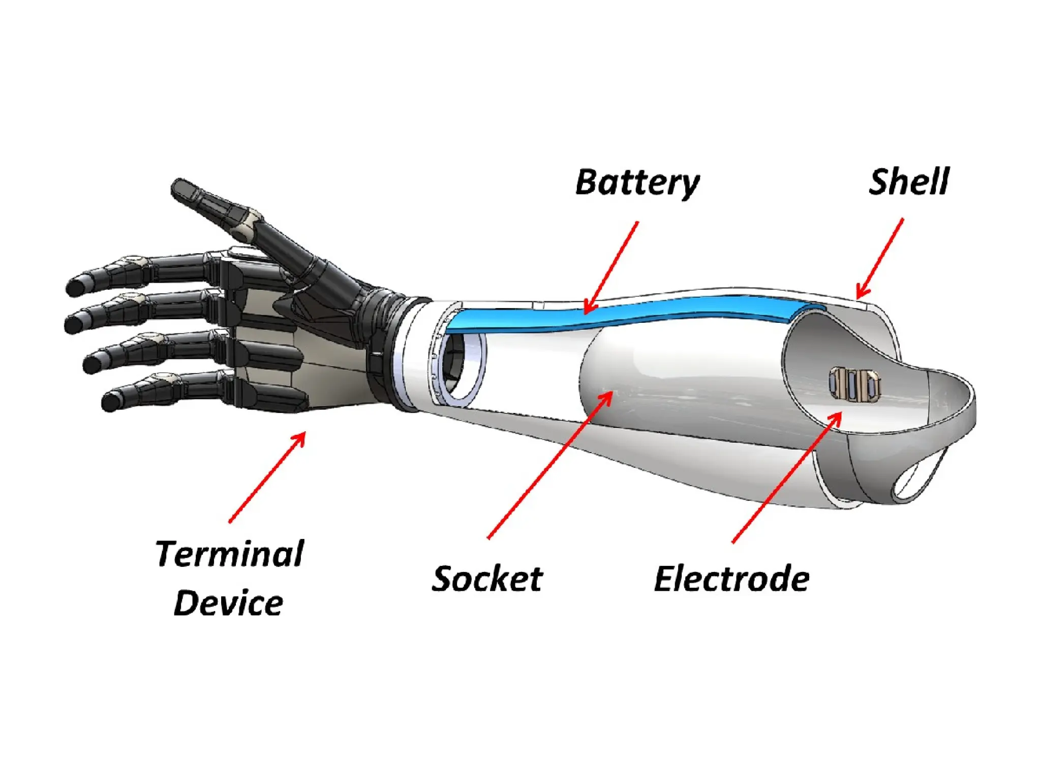 Upper Limb Prosthesis Pptx Pptx