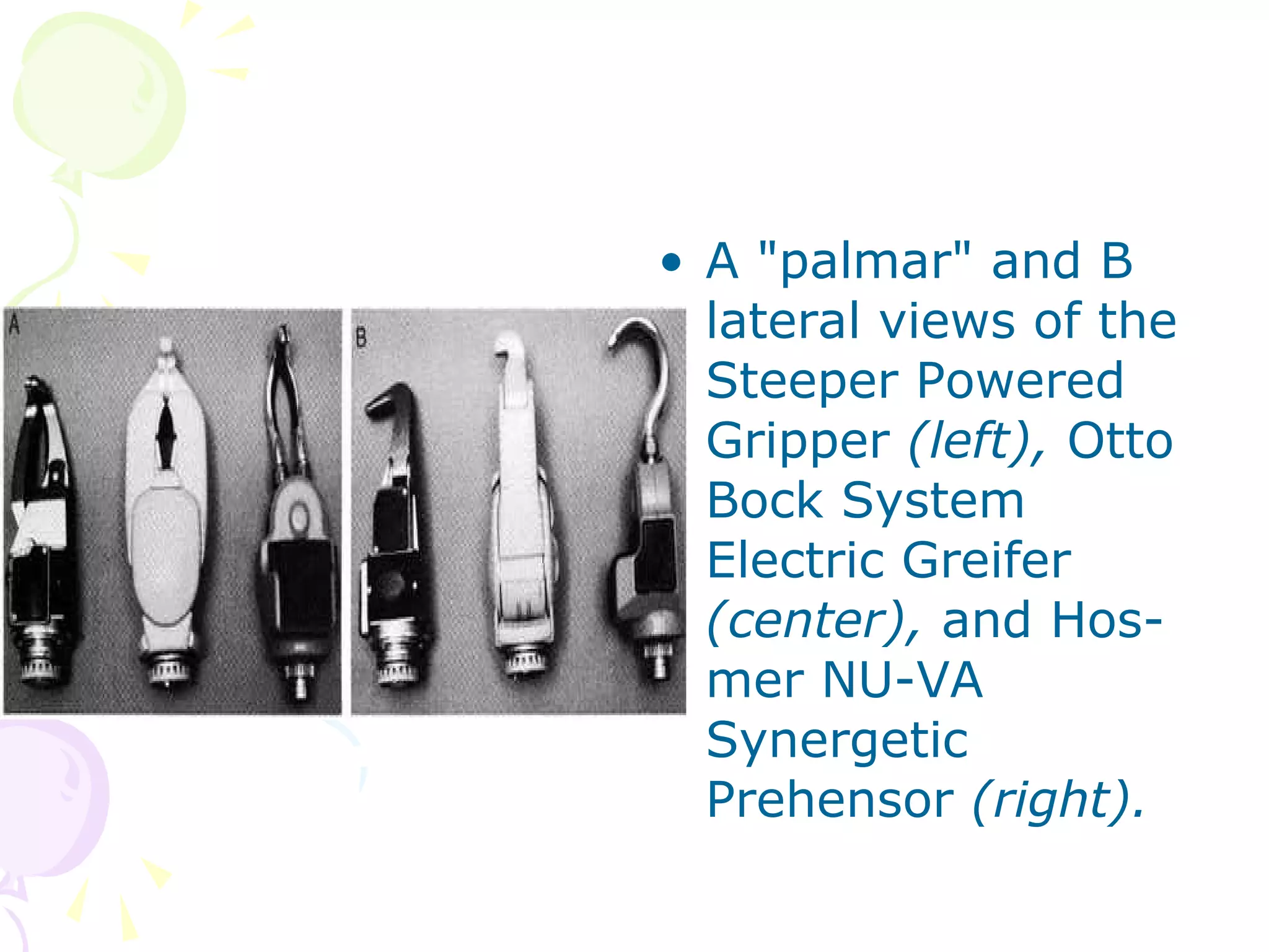 Upper limb prosthesis (pmr) | PPT