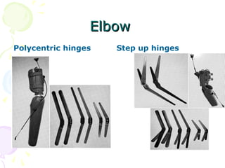 Upper limb prosthesis (pmr) | PPT