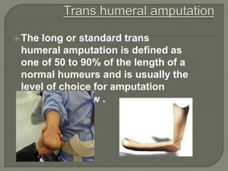 Upper limb prosthesis | PPTX