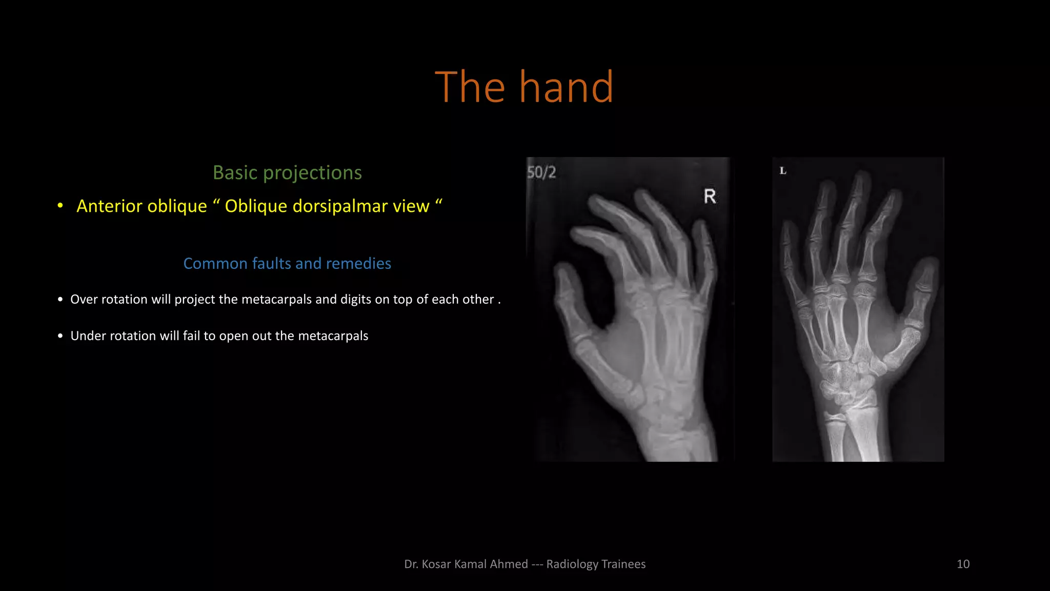 Upper limb radiography | PPTX