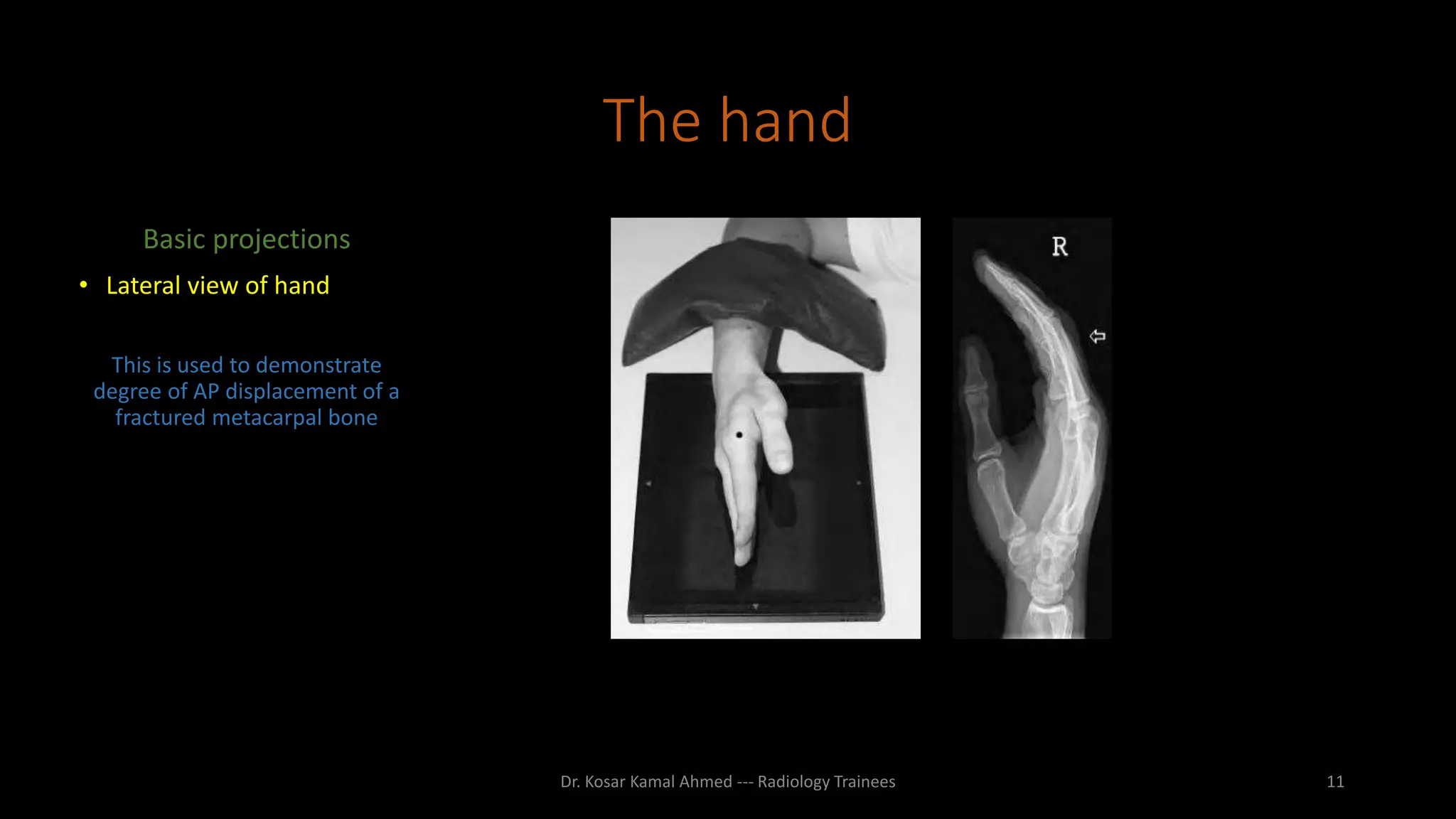 Upper limb radiography | PPTX