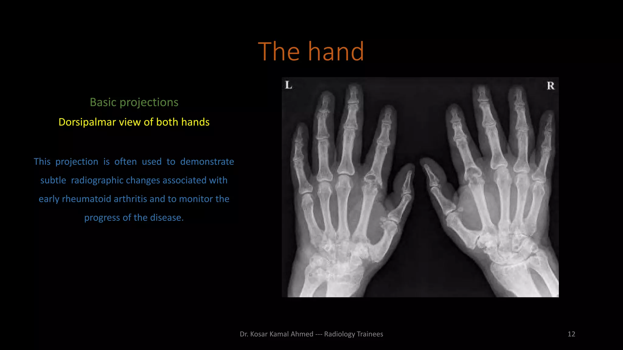 Upper limb radiography | PPTX