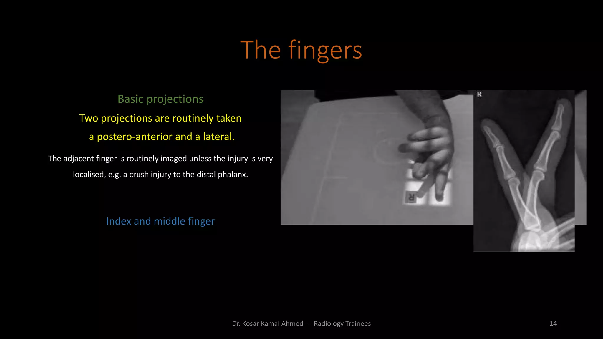 Upper limb radiography | PPTX