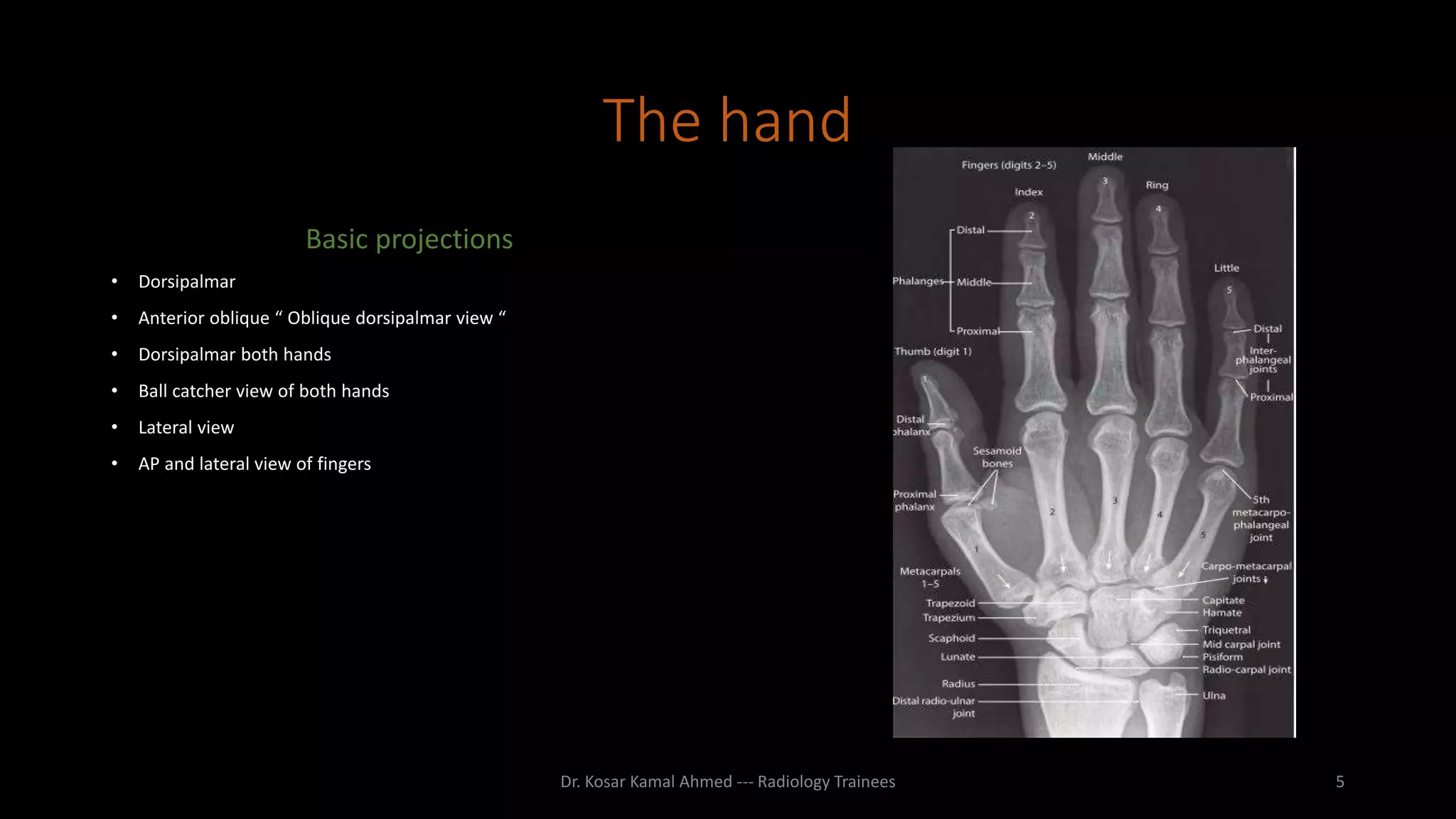 Upper limb radiography | PPTX