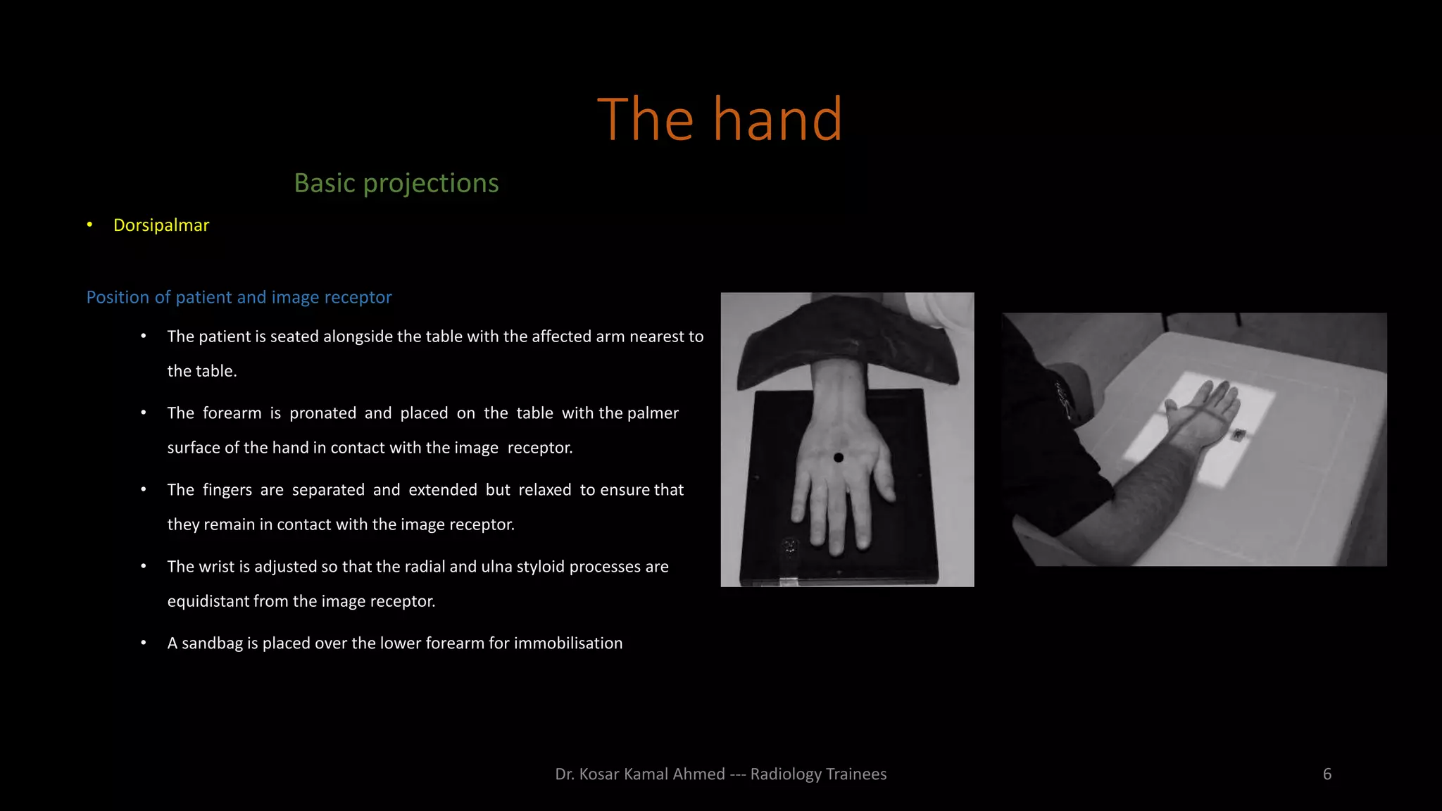 Upper limb radiography | PPTX
