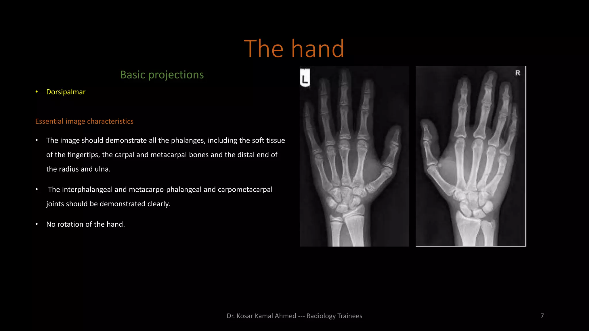 Upper limb radiography | PPTX