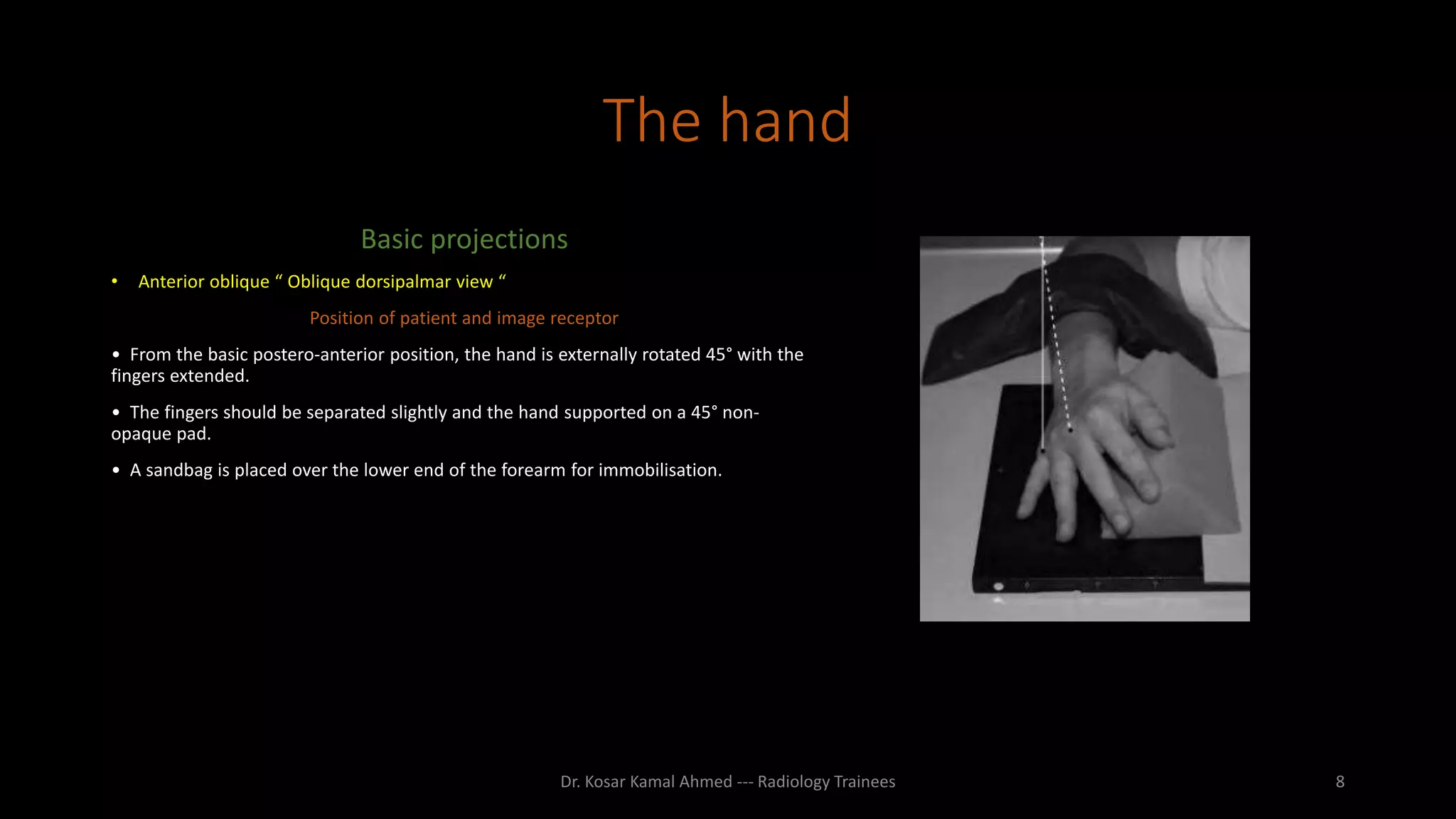 Upper limb radiography | PPTX