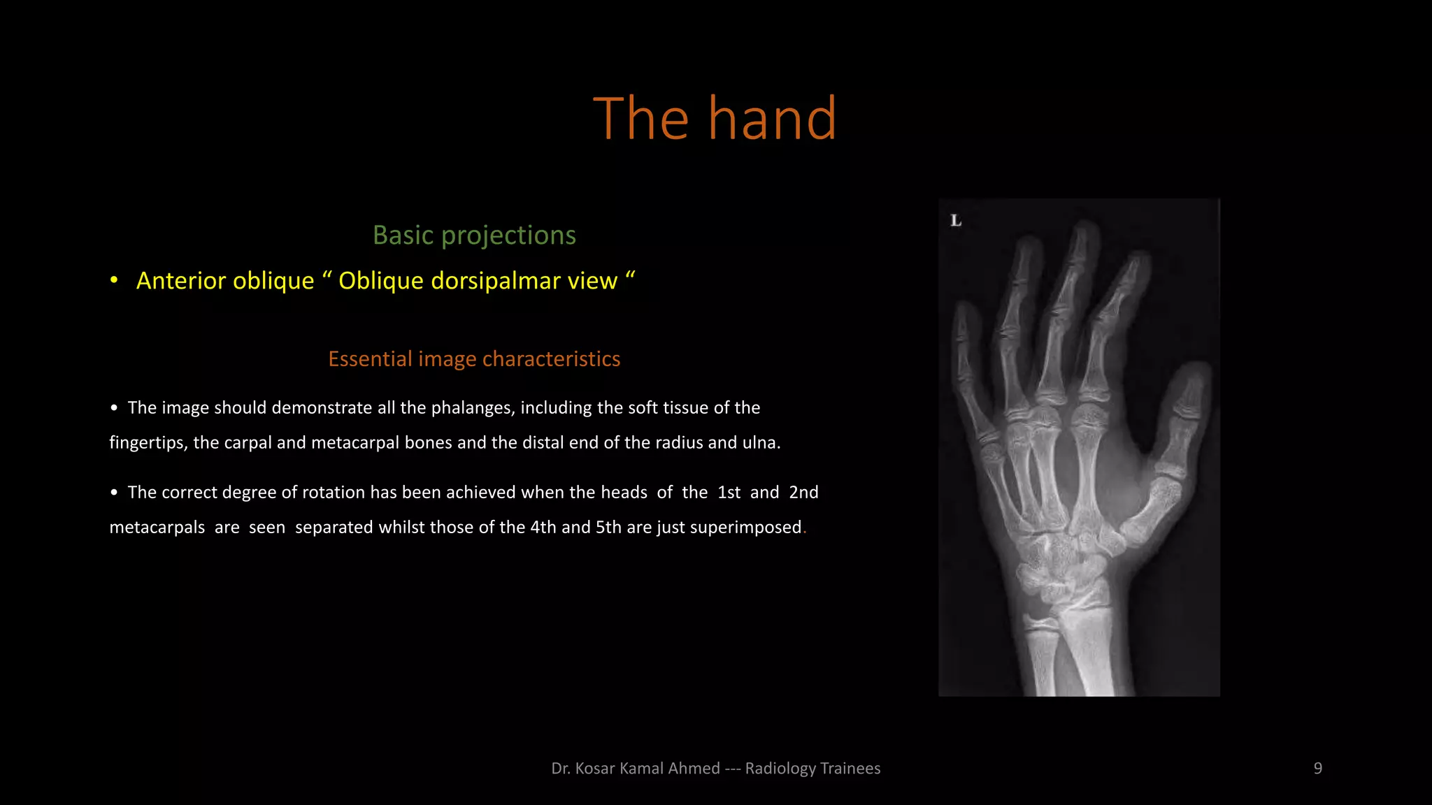 Upper limb radiography | PPTX