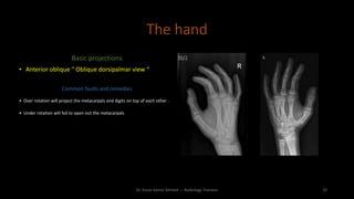 Upper limb radiography | PPTX