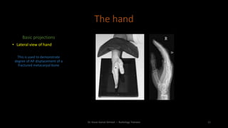 Upper limb radiography | PPTX