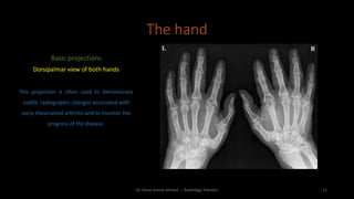 Upper limb radiography | PPTX