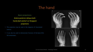 Upper limb radiography | PPTX