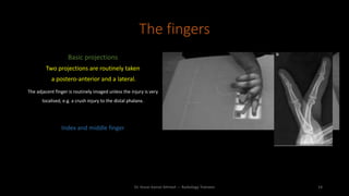Upper limb radiography | PPTX