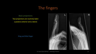 Upper limb radiography | PPTX