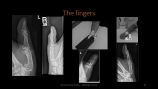 Upper limb radiography | PPTX