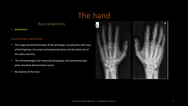 Upper limb radiography | PPTX