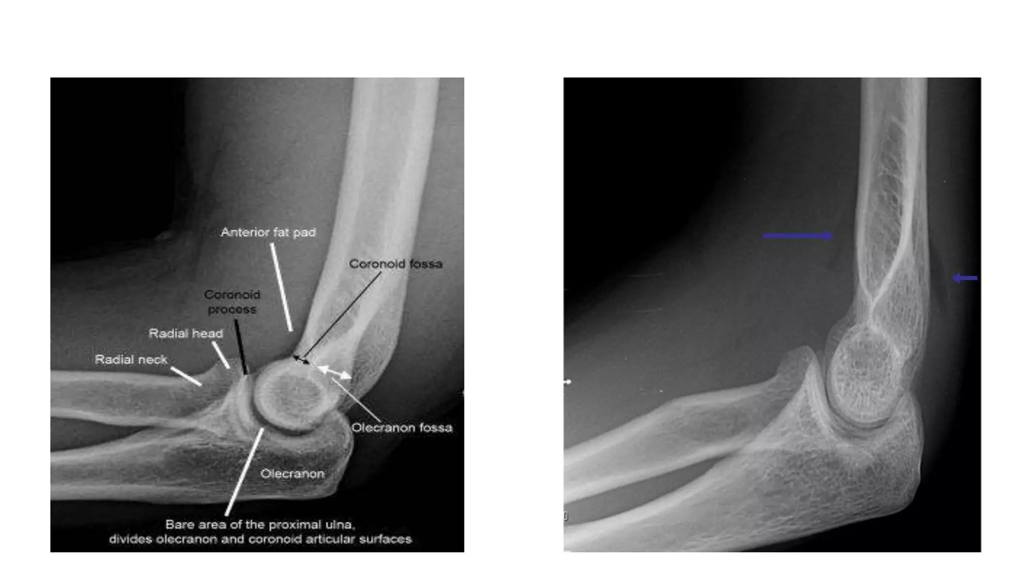 Upper limb radiology | PPTX | Medical Tests | Medical Health