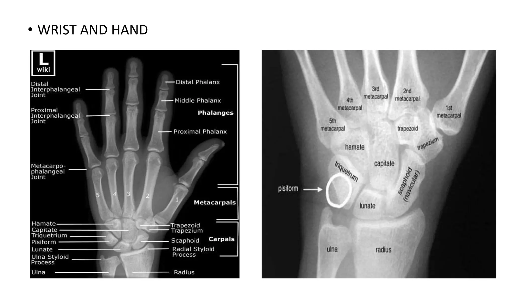 Upper limb radiology | PPTX | Medical Tests | Medical Health