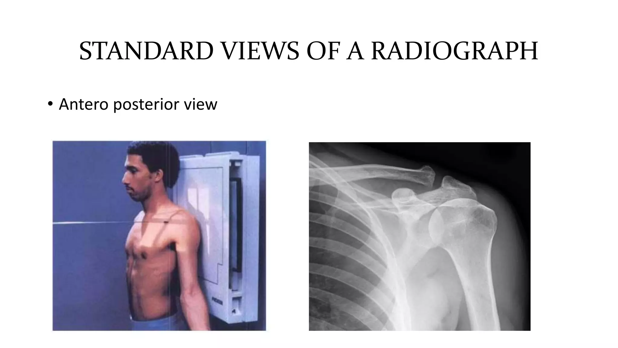 Upper limb radiology | PPTX