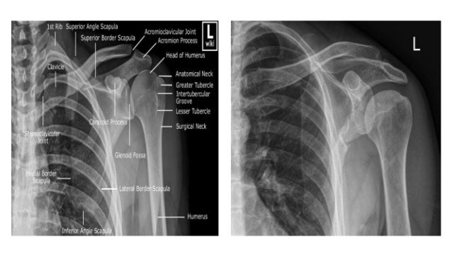 Upper limb radiology